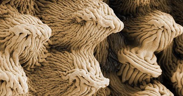 RMS | Basics of Electron Microscopy Virtual Spring School 2021