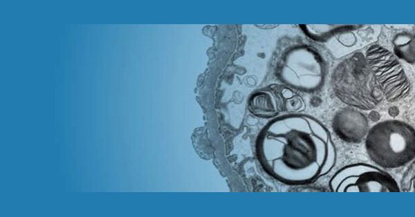 ACEM | How TEM Works