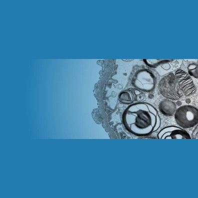 ACEM | How TEM Works