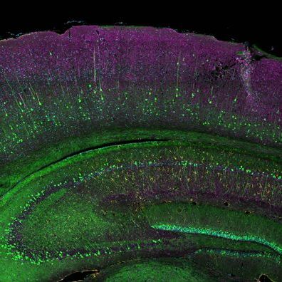 ACEM | Autoflourescence in Focus - The Hidden Light of Biological ...