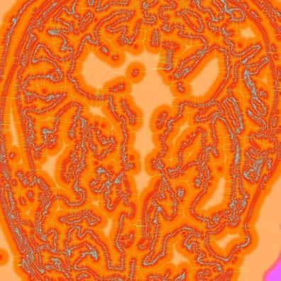 mmc series | infocus #66 June 2022 The Human Brain